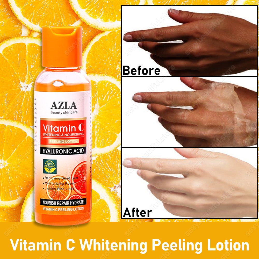 100g AZLA Vitamin C Peeling Lotion Remove Dead Skin Exfoliating ...