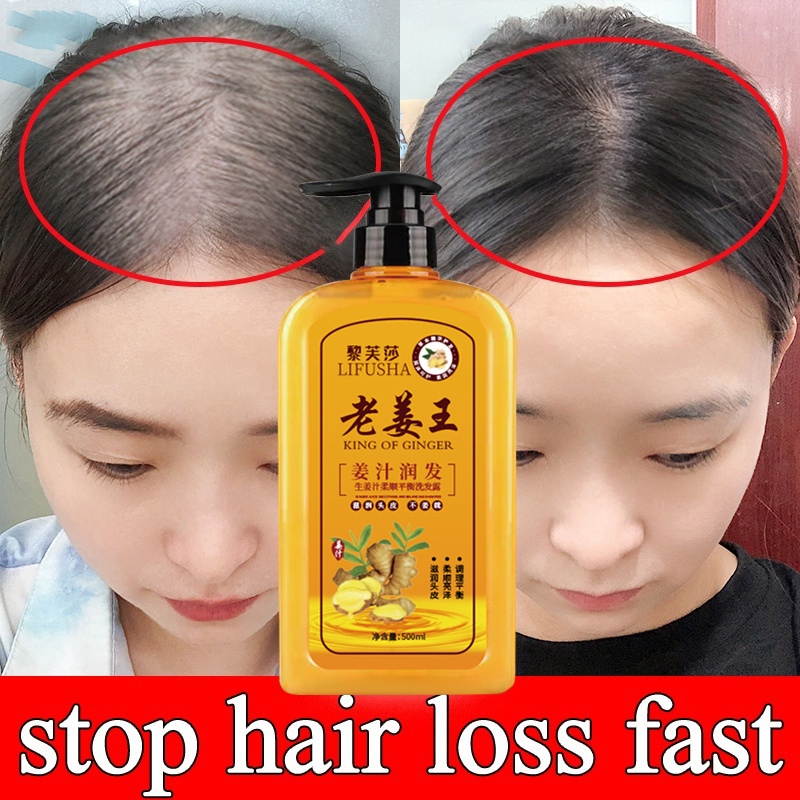 500ML Ginger Hair Shampoo Fast Hair Grower Shampoo Anti-Hair Loss Anti ...