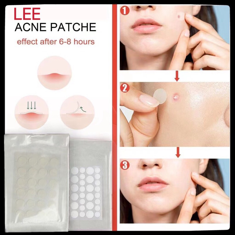LeeSelected 36/72PCS Invisible Acne Pimple Removal Patch Acne ...