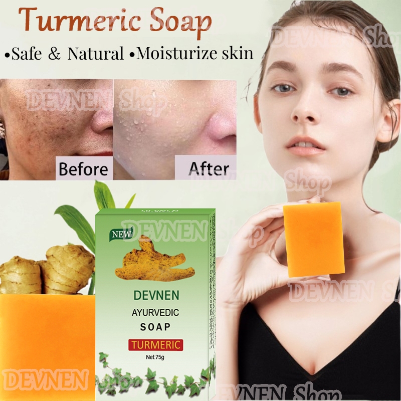 DEVNEN Original Turmeric Whitening Soap Acne Treatment Facial Cleanser ...