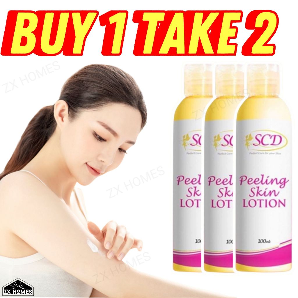 ZX HOMES [HOT! 3PCS] SCD Peeling Lotion 100ml (Removes Melasma ...