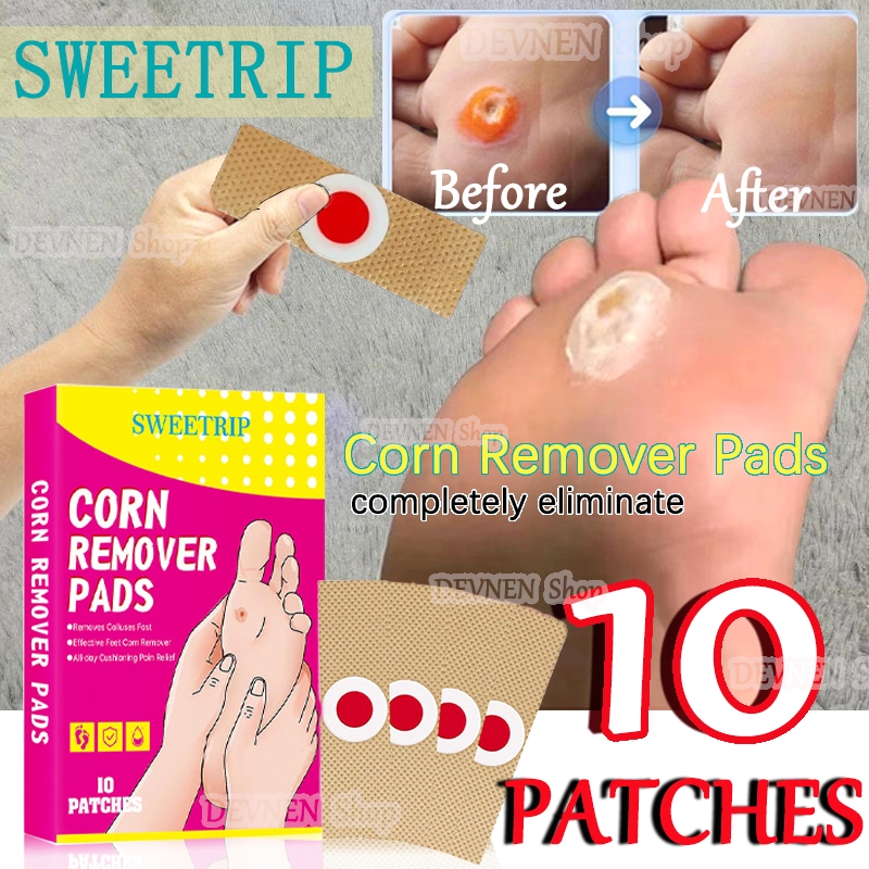 SWEETRIP Foot Corns Remover Patch Remove Calluses On The Feet Patch ...