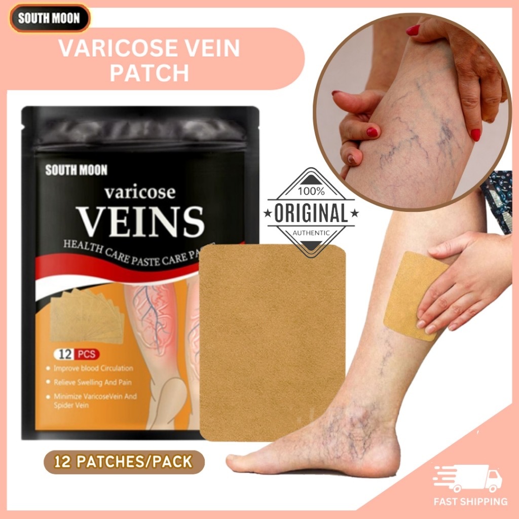 Varicose Vein Plaster Patches Smooth bulging blood vessels Varicose ...