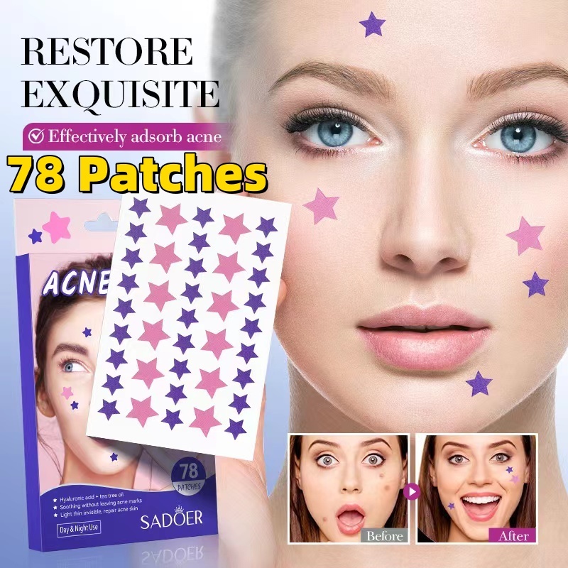 SADOER Colorful Star Acne Pimple Patch Stickers Colored Hydrocolloid ...