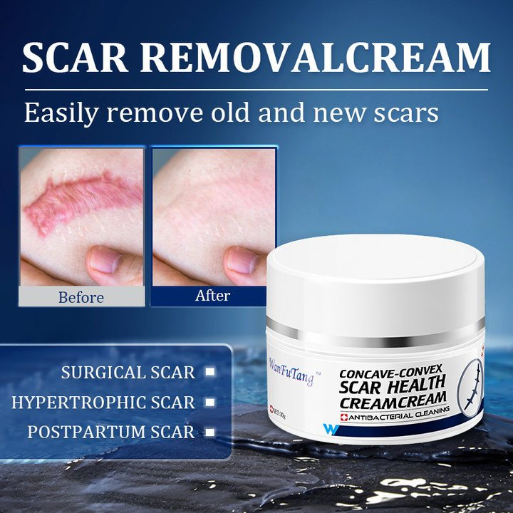 Scar Remover Cream Old Scar Effective Remover Scar Minimizer Cream Acne ...