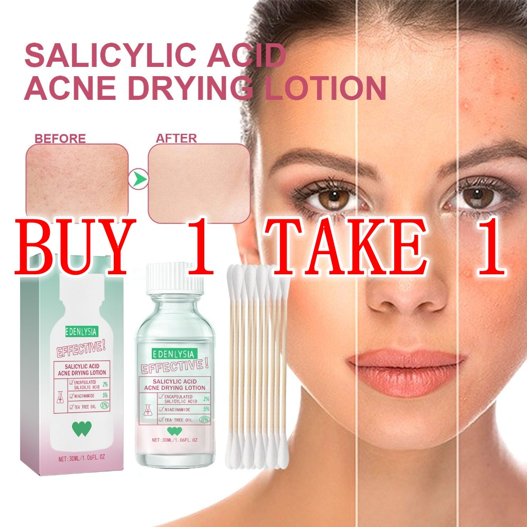 【BUY 1 TAKE 1】Pimple Warrior Salicylic Acid Acne Drying Lotion - With ...