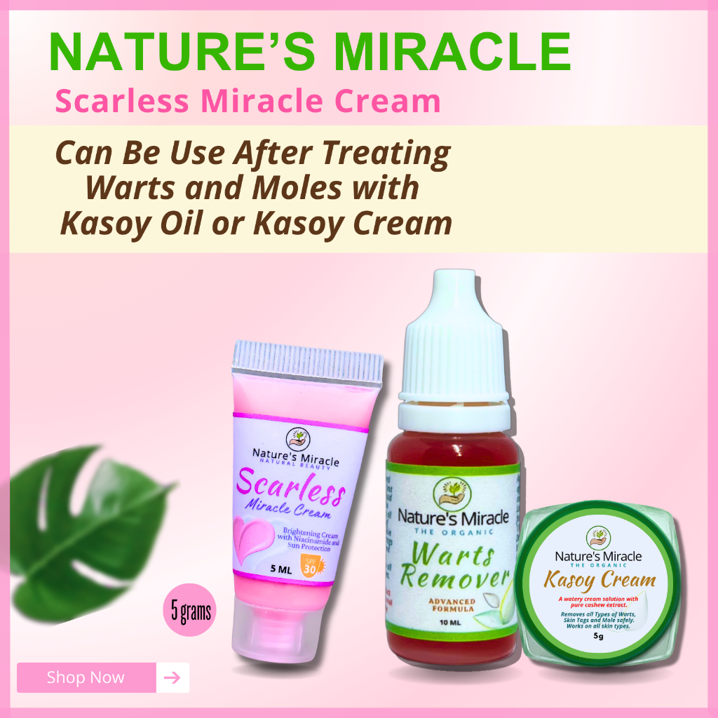 Strong Kasoy Cream Original mole millia syringoma cream wart remover ...
