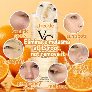 300ml Vitamin C Whitening Toner Orange Peeling Toner Remove Melasma ...