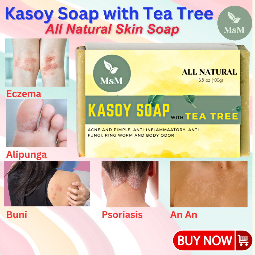 Anti fungal Kasoy Medicinal Soap for Sensitive Skin | Sabon sa Kati sa Balat ng Bata | An An ...