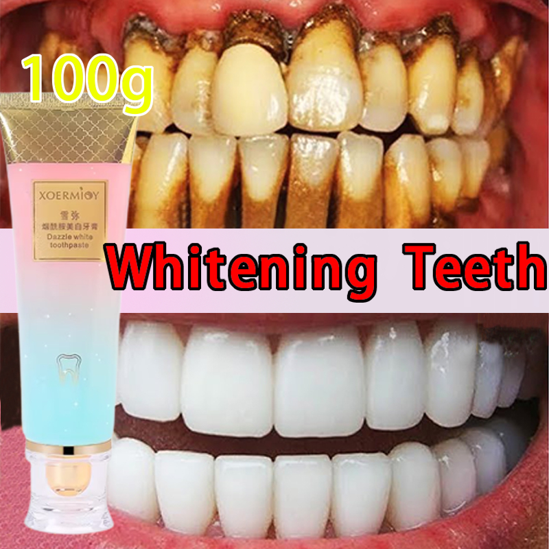 Teeth Whitening Toothpaste Niacinamide Toothpaste Remove Plaque Oral ...