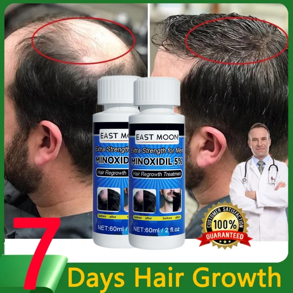Minoxidil Strands 5% Minoxidil Anti Hair Loss Liquid Promote Thick Fast ...
