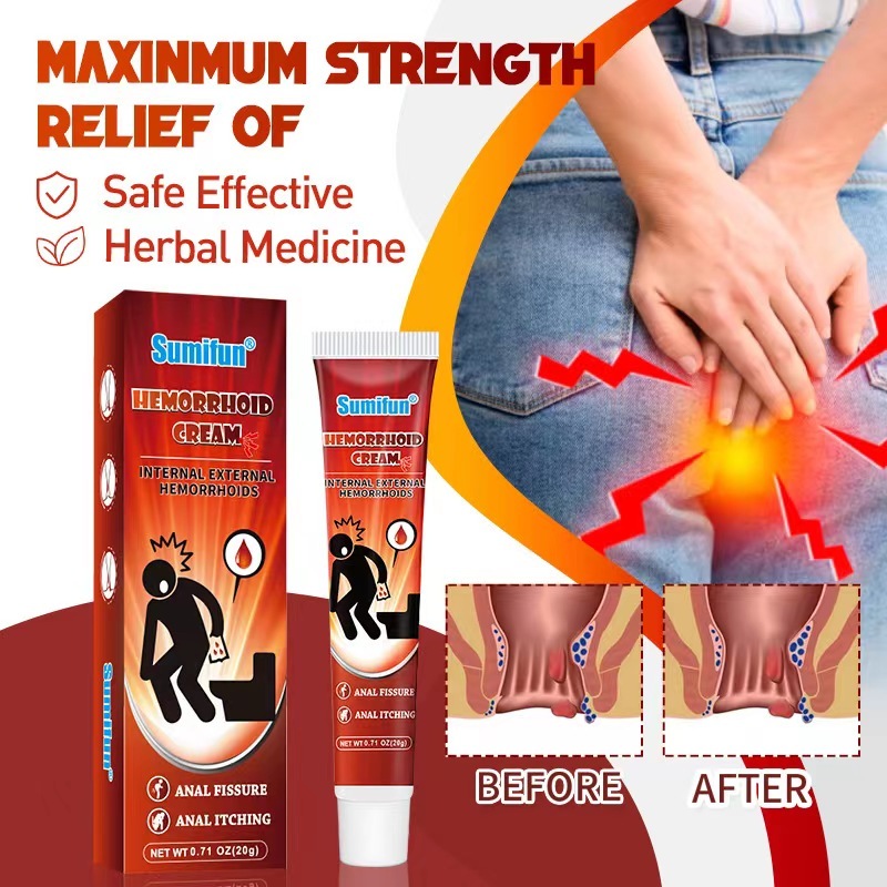 Hemorrhoids CreamHemorrhoids Ointment for Anal Fissure Gamot Almoranas ...