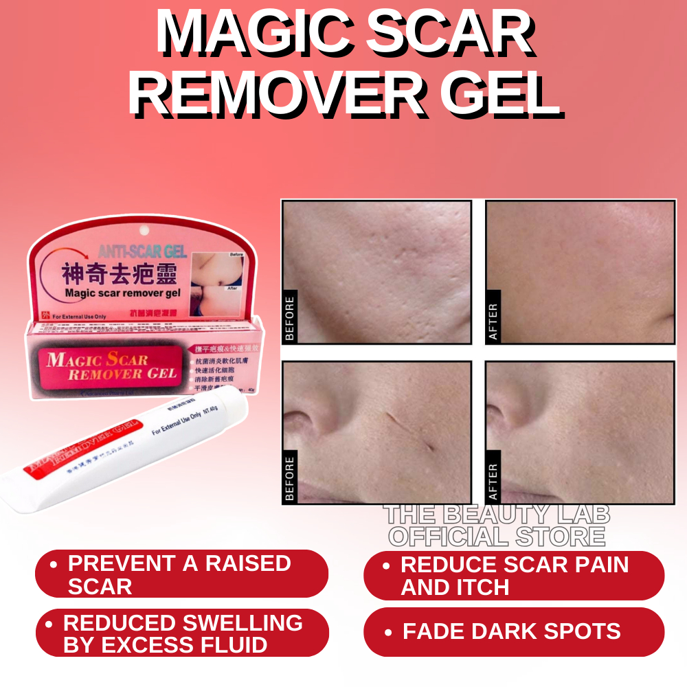 Scar Remover Gel Anti-Scar Magic Effective Removes All Kinds of Scars ...
