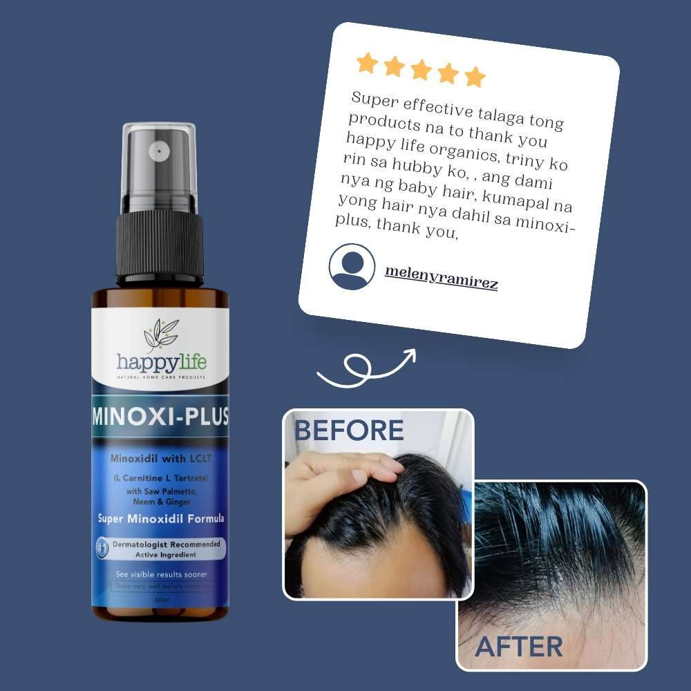 Minoxidil 5% MINOXIPLUS LCLT Hair Grower, Serum, Men, Women, Alopecia ...