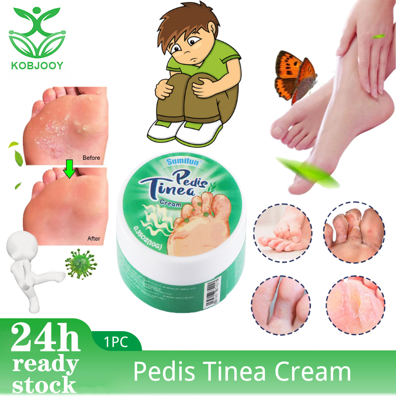 Pedis Tinea Cream Treat Beriberi Athlete's Foot RemoveOdor Toe Peeling Anti-itching ...