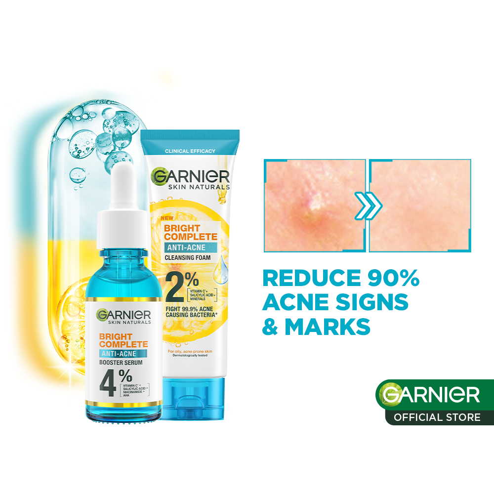 Garnier Anti Acne Serum 30ml Niacinamide Serum And Anti Acne Foam ...