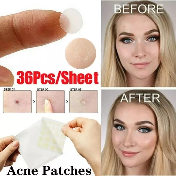 LY.36pcs/patch acne patch Salicylic Pimple Patch Blemish Treatment Skin ...