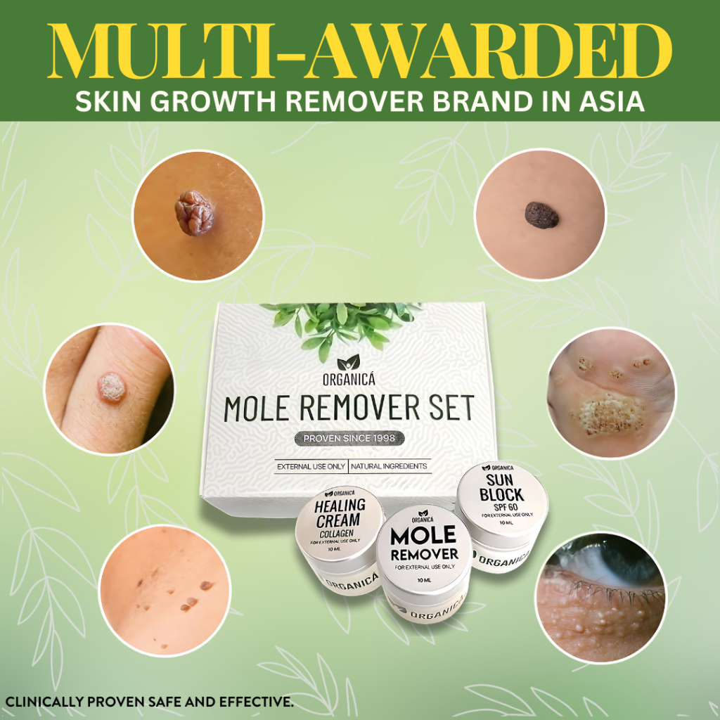 Organica Mole and Warts Remover Set | Shopee Philippines
