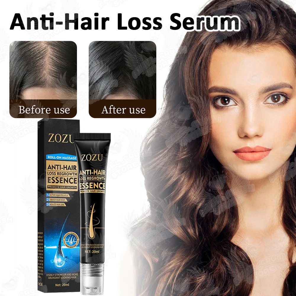 Fast Hair Growth Essence Anti Hair Loss Treatment Serum Repair Seborrheic Hair Loss Oil Care