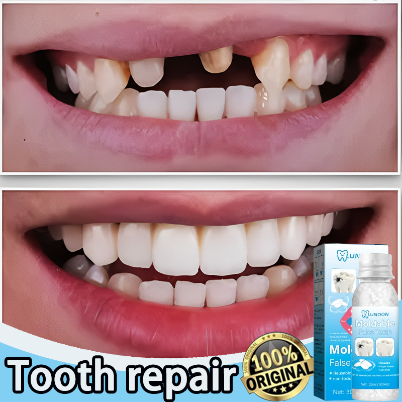 Tooth repair moldable false teeth original temporary teeth 30ml ...