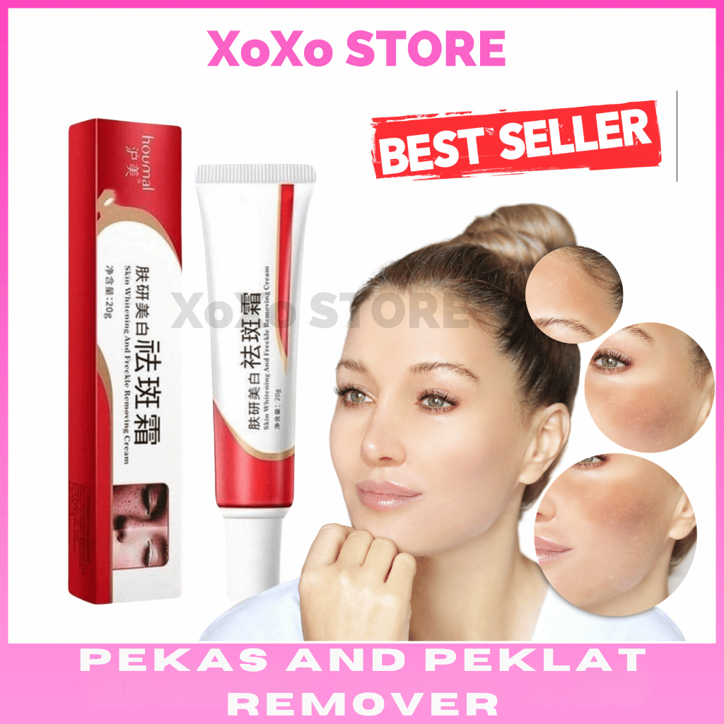 Pekas Cream Remover Original - Melasma & Dark Spot Removal Cream & Skin ...