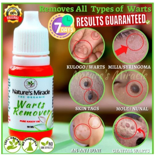 Natures Miracle Warts Remover Warts Remover Original Mole And Warts ...