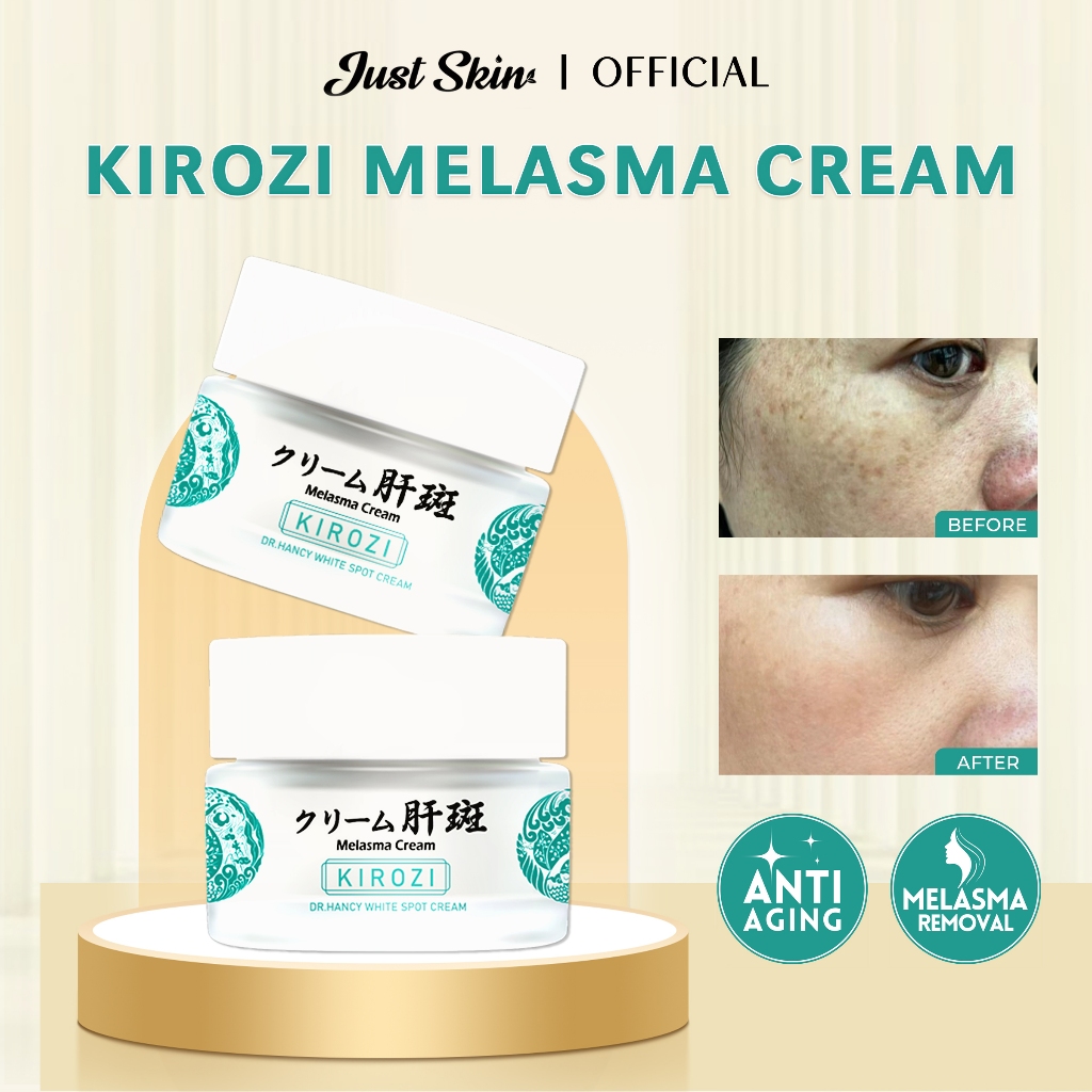 Japanese Kirozi Melasma Cream - Pekas Remover Effective Anti-Freckle ...