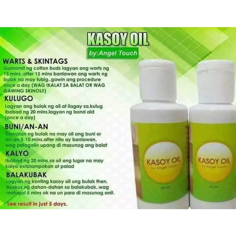 Casoy Oil & Cream Skin Tags, Skin Growth, Mole Remover, Nunal, Kulugo ...