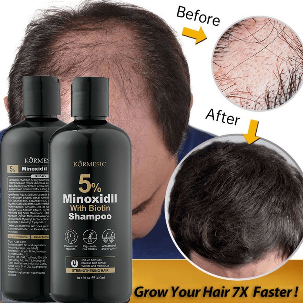Minoxidil Hair Shampoo with Biotin Hair Grower Anti Hair Loss Anti ...