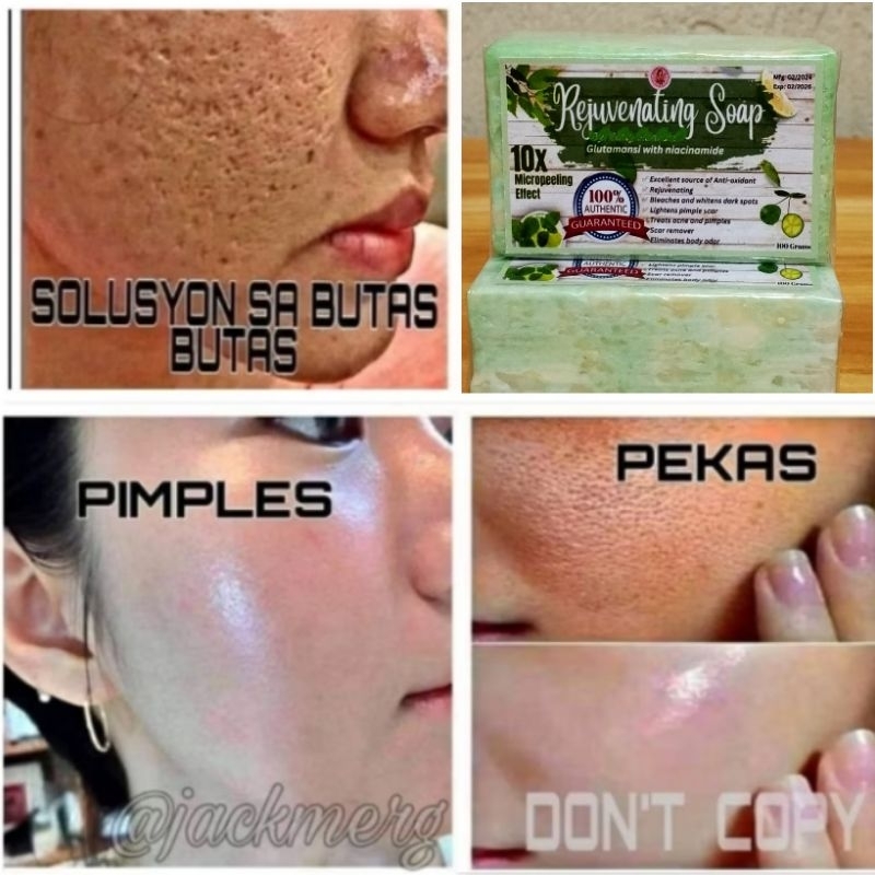 100% ORIGINAL REJUVENATING SOAP 10X MICROPEELING EFFECT | Shopee ...