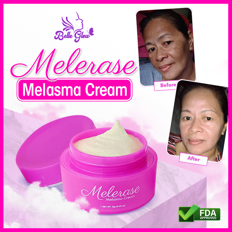Melerase Melasma Cream Pekas Remover Original Effective Best Selling ...