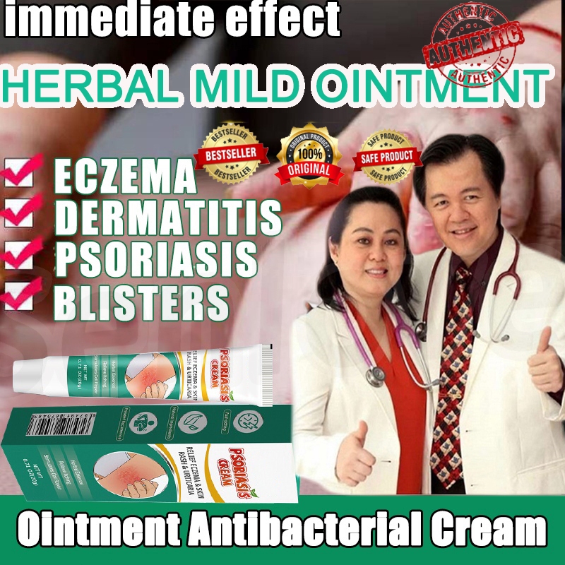 SENLOVE 20G Psoriasis Cream Eczema Ointment Antibacterial Anti Itching ...