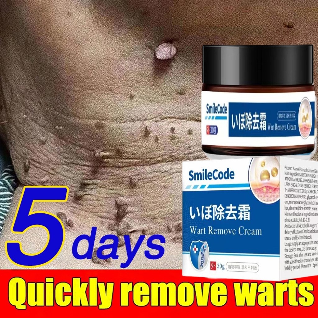 Warts Remover Original Cream 10g Warts Magic Remover Wartz Removal ...