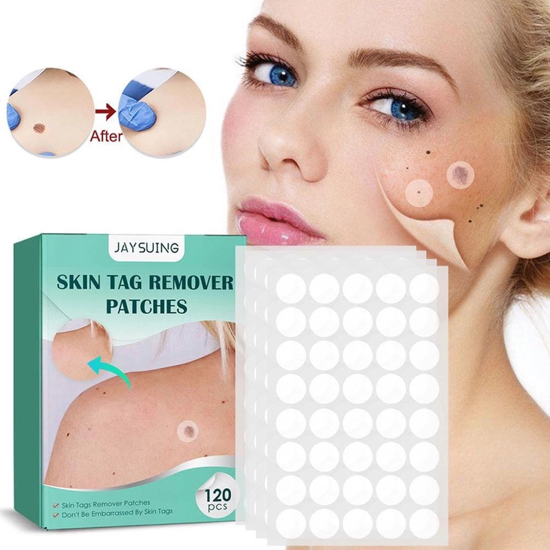 120PCS/Box Warts Remover Patch Safe Painless Skin Tags Patches Pimple ...