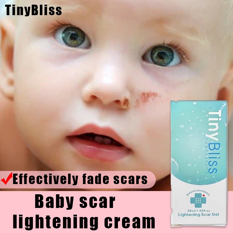 TinyBliss 30ml baby scar remover eliminate old scars or soften existing ...