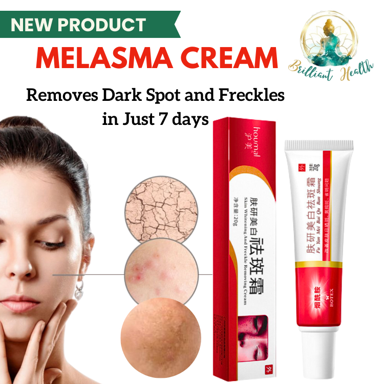 Melasma Cream Pekas remover original Pekas Cream Melasma Remover Cream ...