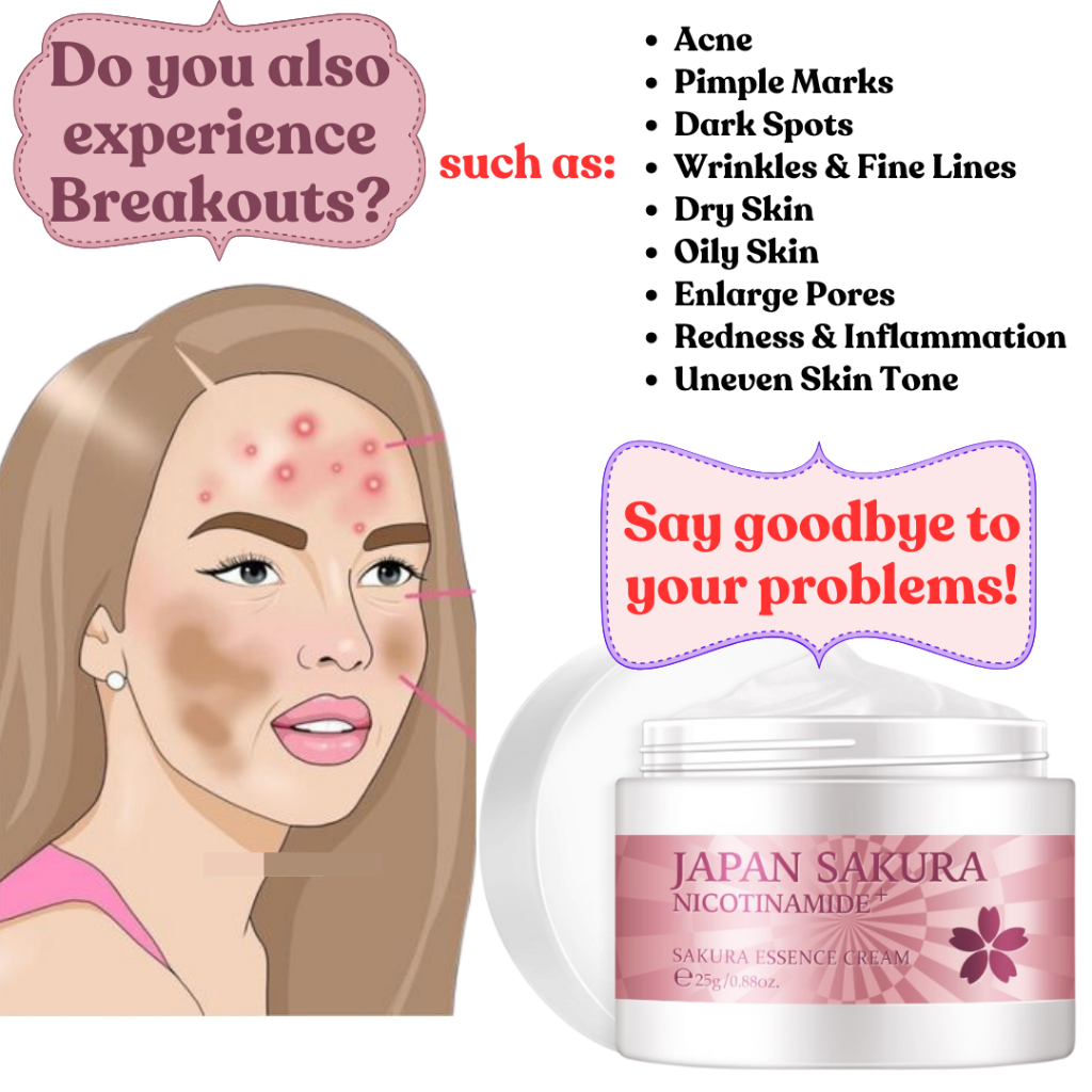 Sakura Cream Japan for Melasma Remover Dark Spot Treatment Whitening ...