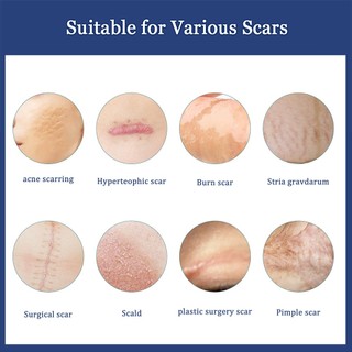 Scars Remover Cream Gel Original From Japan For Old Scar Care ...