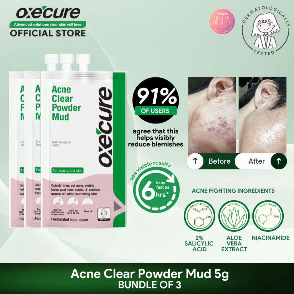 OXECURE 2% Salicylic Acid Acne Clear Powder Mud, Bundle of 3 | Shopee ...