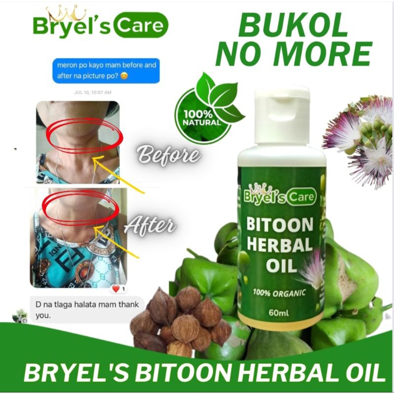 𝘽𝙧𝙮𝙚𝙡'𝙨 𝘾𝙖𝙧𝙚™️ 𝗕𝗶𝘁𝗼𝗼𝗻 𝗛𝗲𝗿𝗯𝗮𝗹 𝗢𝗶𝗹 𝗕𝗮𝗿𝗿𝗶𝗻𝗴𝘁𝗼𝗻𝗶𝗮 𝗔𝘀𝗶𝗮𝘁𝗶𝗰𝗮 Cysts, Goiter, Rayuma, Sugar, Maga ...