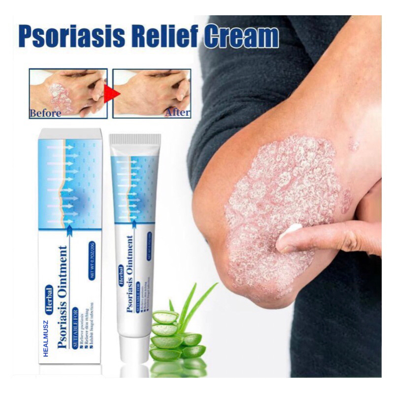 HEALMUSZ Herbal Psoriasis Ointment Suitable For Relieve Skin Itching ...