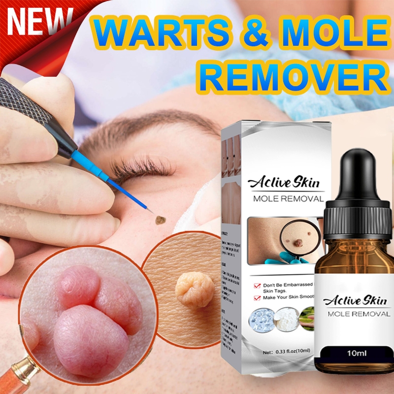Warts Remover Original Serum Kulugo Skin Tags Mole Remover Foot Corn ...
