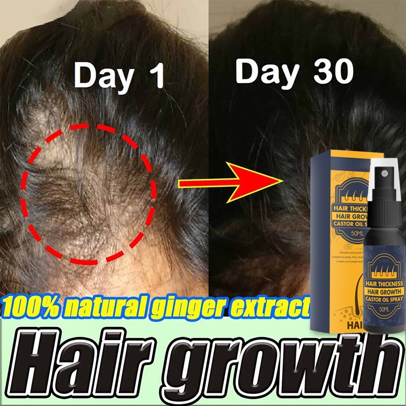 Castor Oil Hair Grower Spray Rapid Hair Growth Essence Anti Hair Loss ...