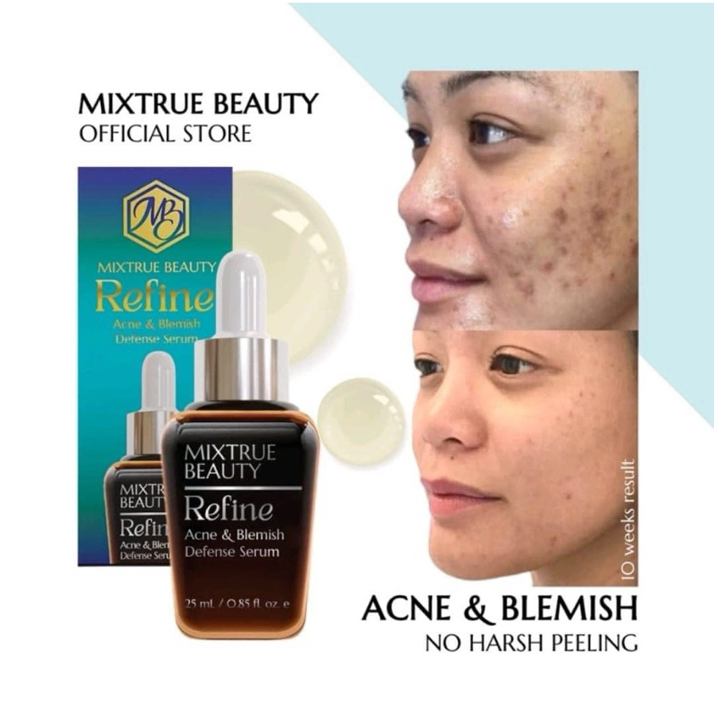 Mixtrue Beauty Refine Serum (For Acne Scars & Blemishes) | Shopee ...