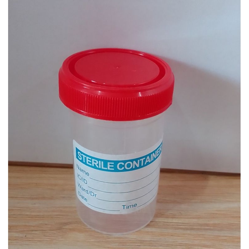 Urine Container sterile 60ml | Shopee Philippines
