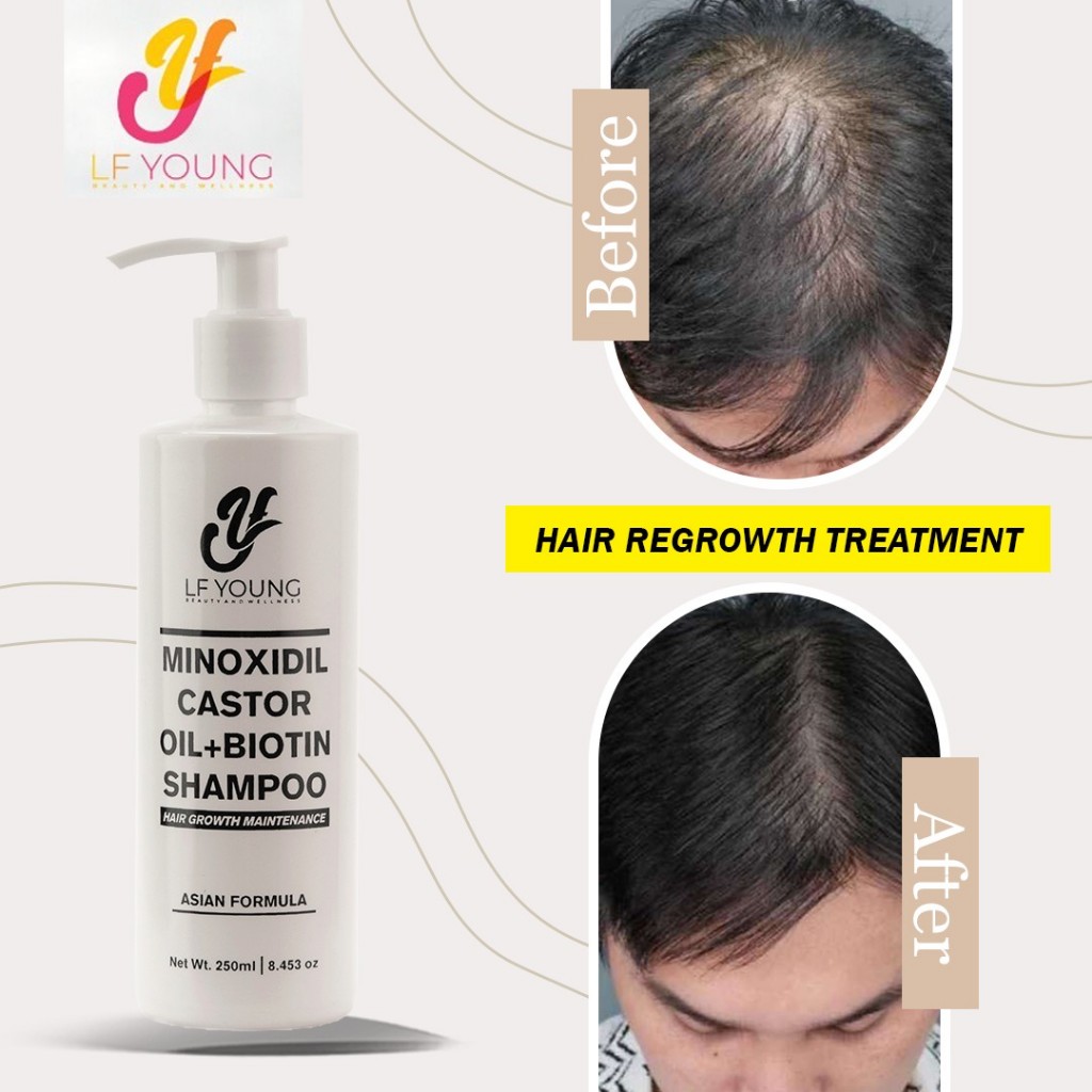 Minoxidil Hair Grower Shampoo With Biotin And Castor Oil 250ml For Hair