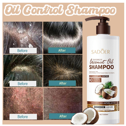 Coconut Shampoo Anti-Dandruff Repair Damage Hair Dry Hair Care Control Oil Shampoo 500ml ...