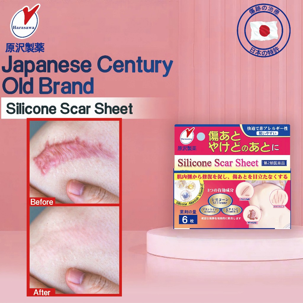 Harasawa Silicone Scar Sheet Old Scar Peklat Removal Stretch Mark ...