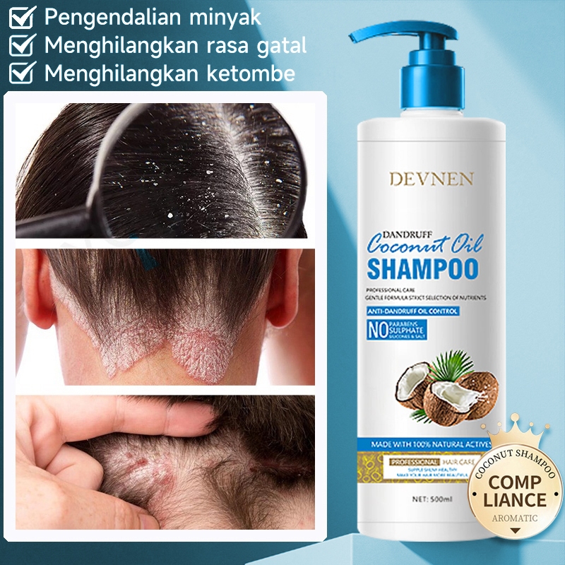 DEVNEN Coconut Oil Shampoo Anti Dandruff Oil Control Refreshing Fluffy Long Lasting Fragrance ...