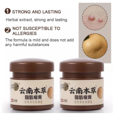 20g Lipoma Removal Cream Treat Tumor Skin Swelling Ointment Herbal ...